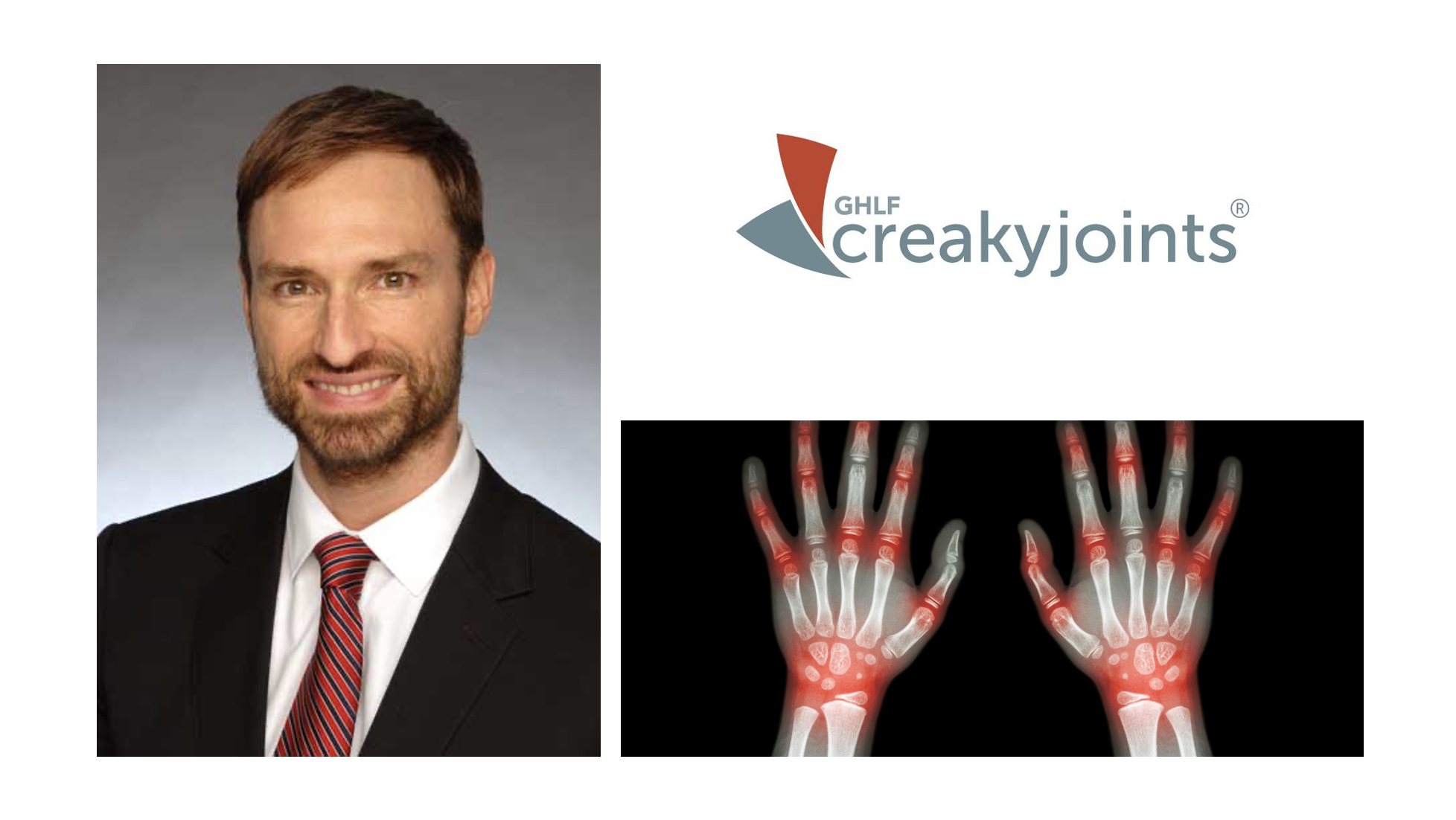 Benjamin Nowell, PhD: The Importance of Patient-Reported Outcomes and ...