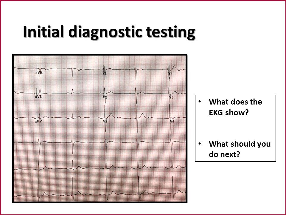 ECG Challenge: AMS and Thirst