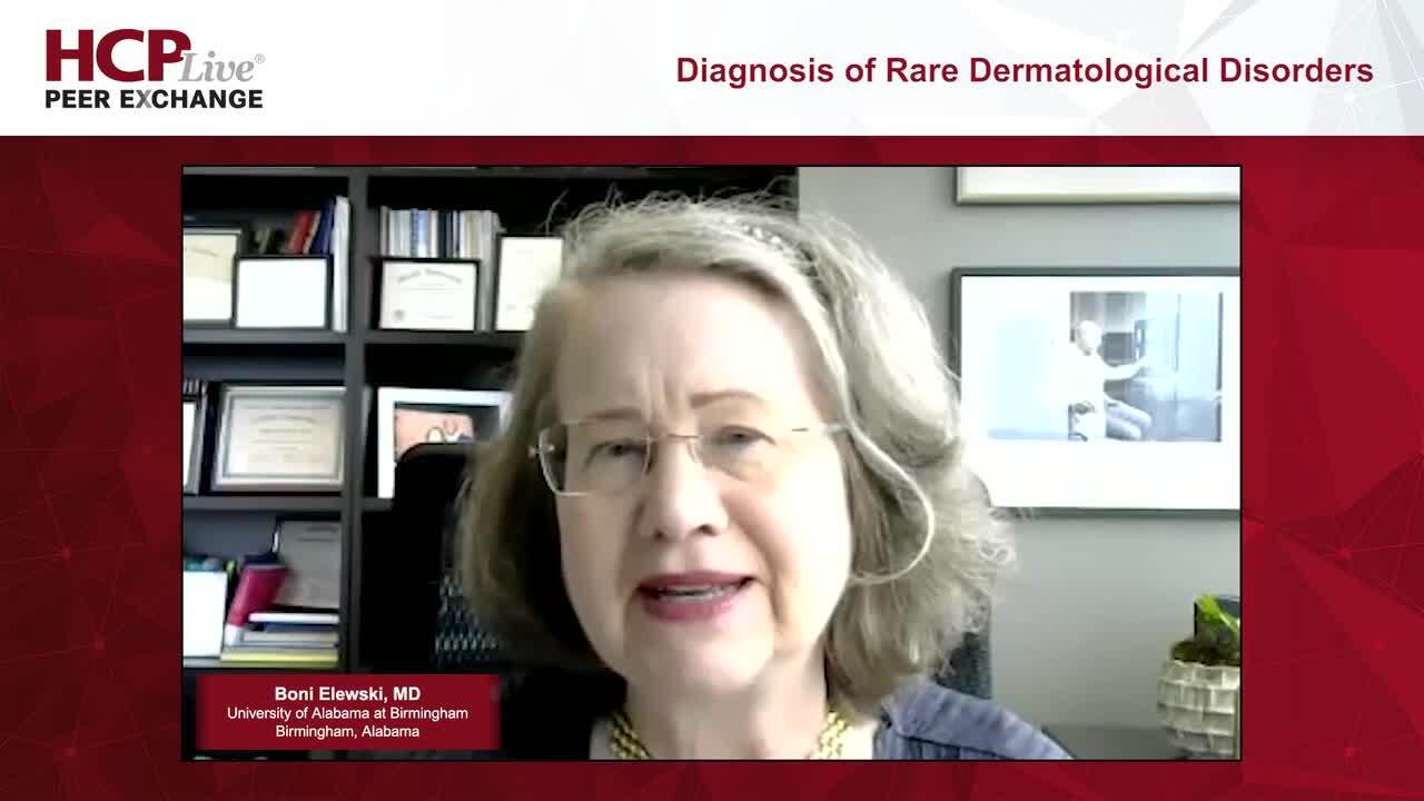 Diagnosis of Rare Dermatological Disorders | HCPLive