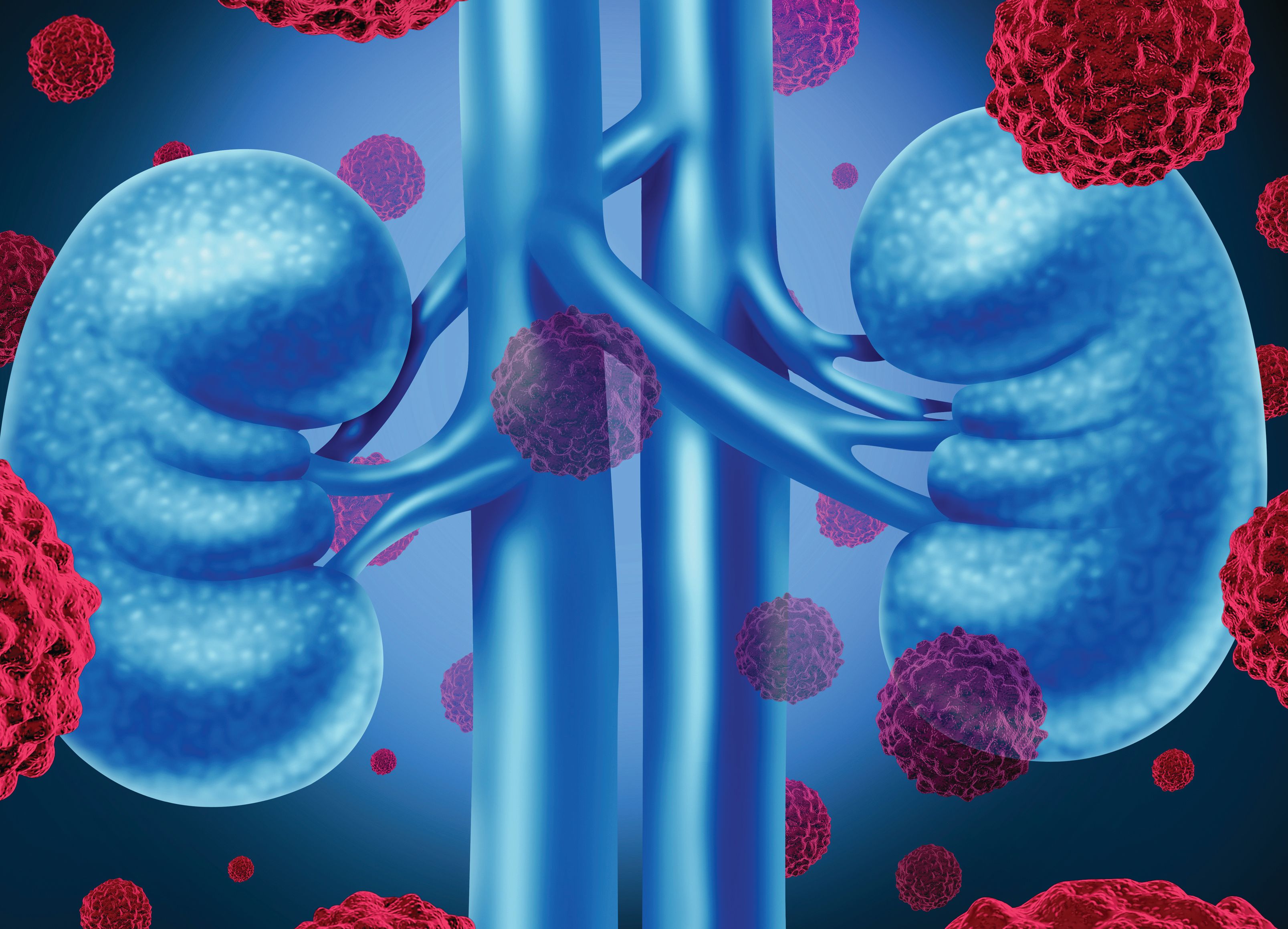 Renal Failure Risk Group Classification Predicts Kidney Dysfunction in IgAN