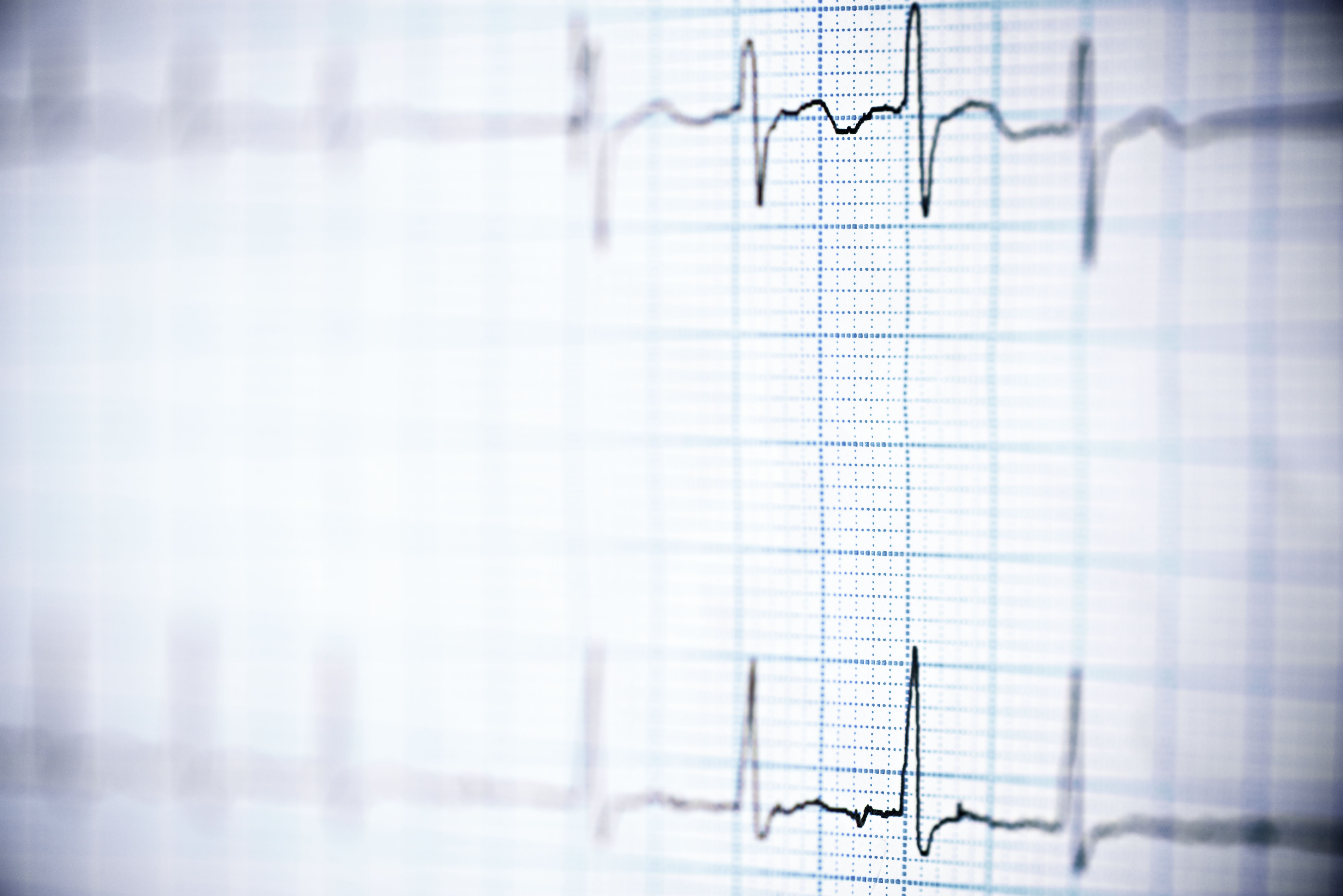 Analysis Suggests Wealthier Countries Seeing Greater Incidence of AFib ...