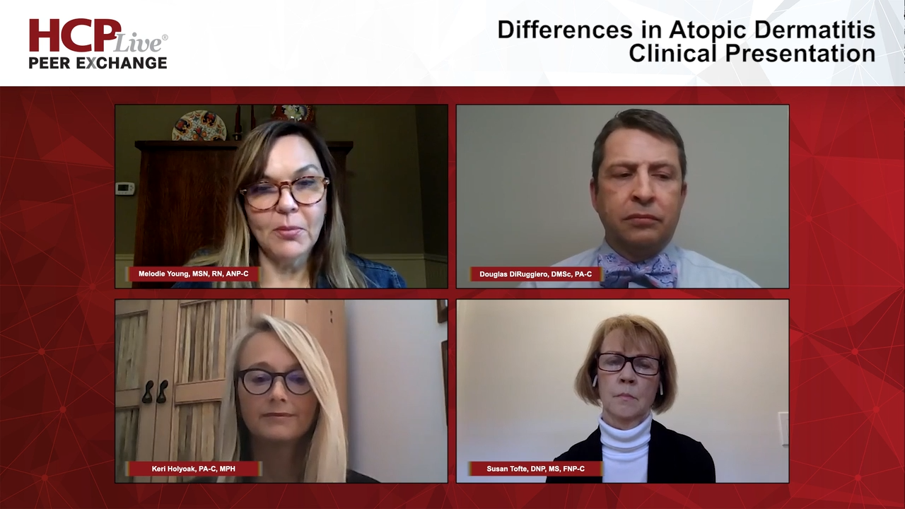 Differences in Atopic Dermatitis Clinical Presentation