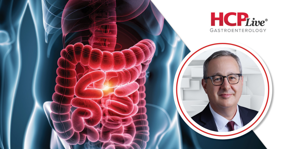 Obefazimod As An “Exciting” Potential Treatment for Ulcerative Colitis ...