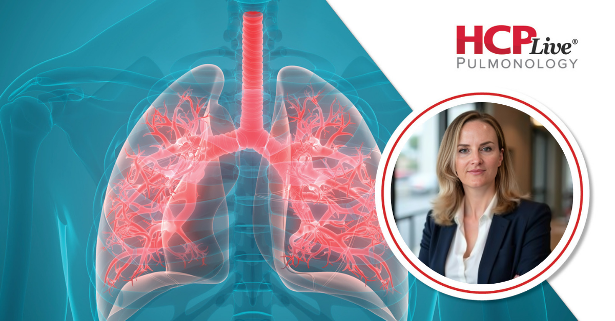 Safeguards in New Lung Cancer Risk Calculator, With Jessica Moffatt ...