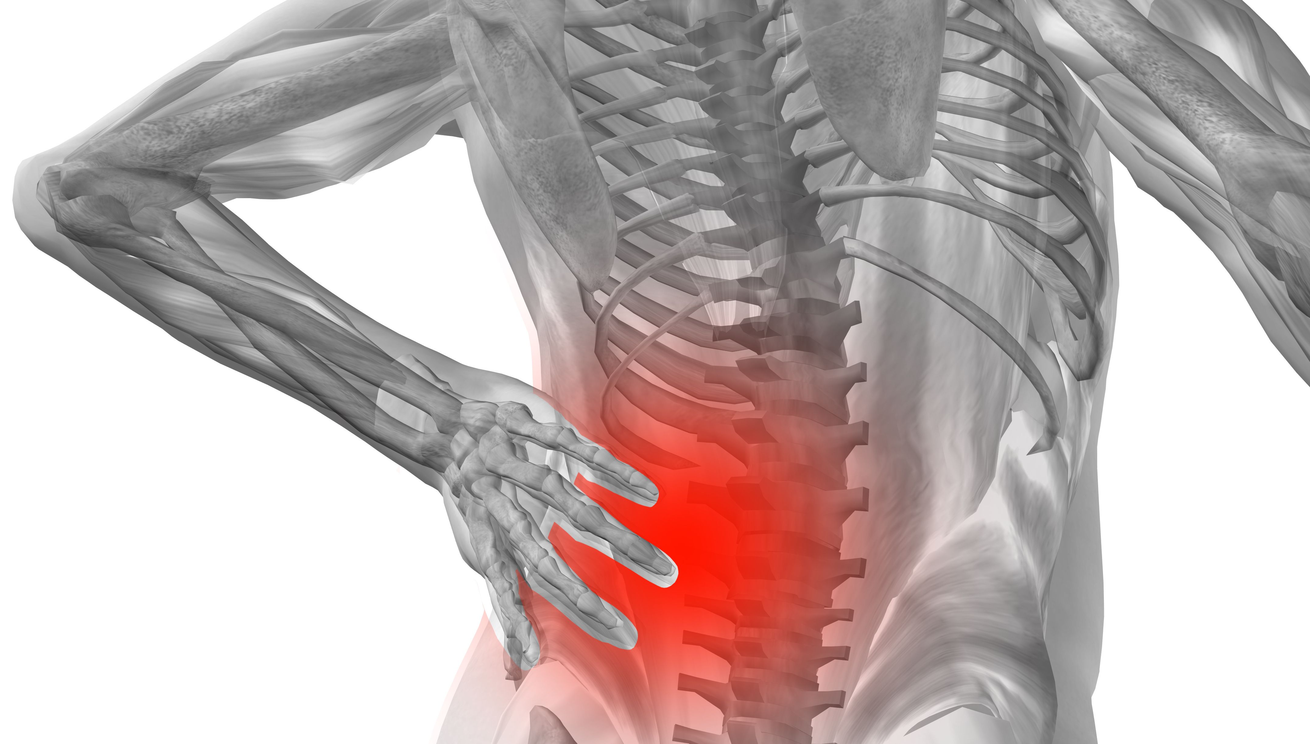 Combination TNFi plus NSAIDs Provided Little Additional Benefit to TNFi ...