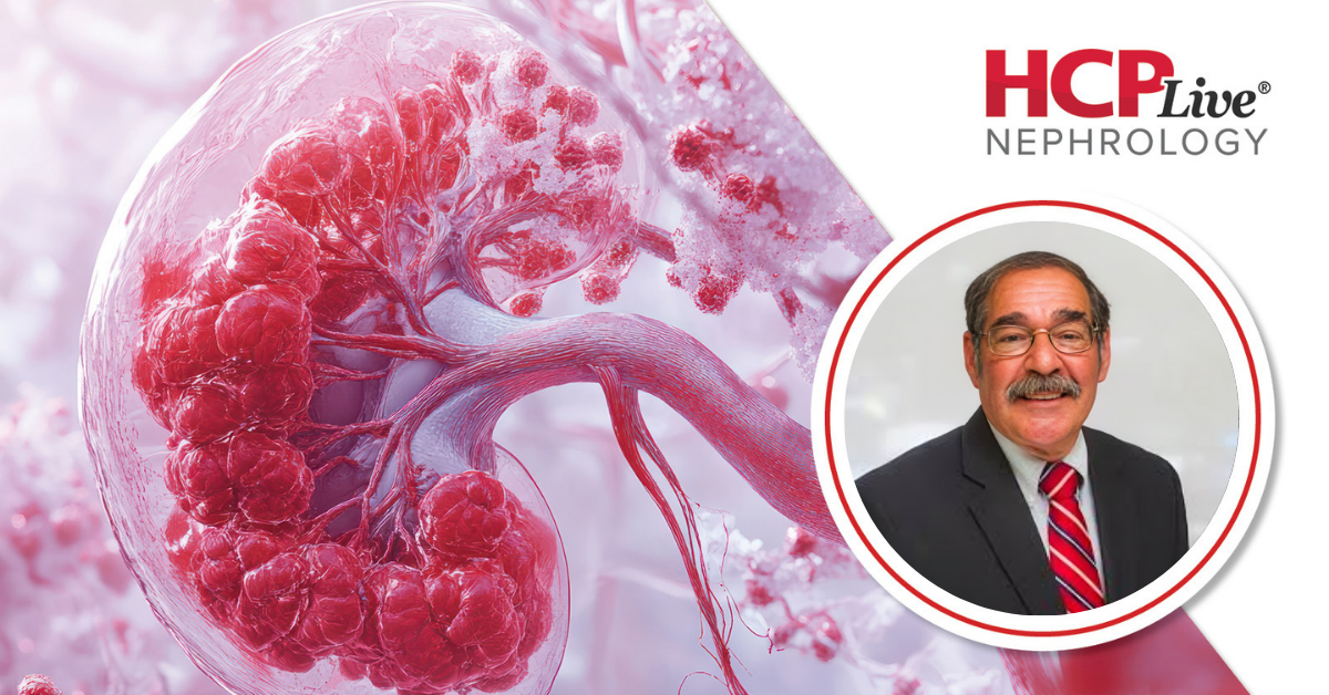 How the 2025 KDIGO Guidelines Are Personalizing IgA Nephropathy Care ...