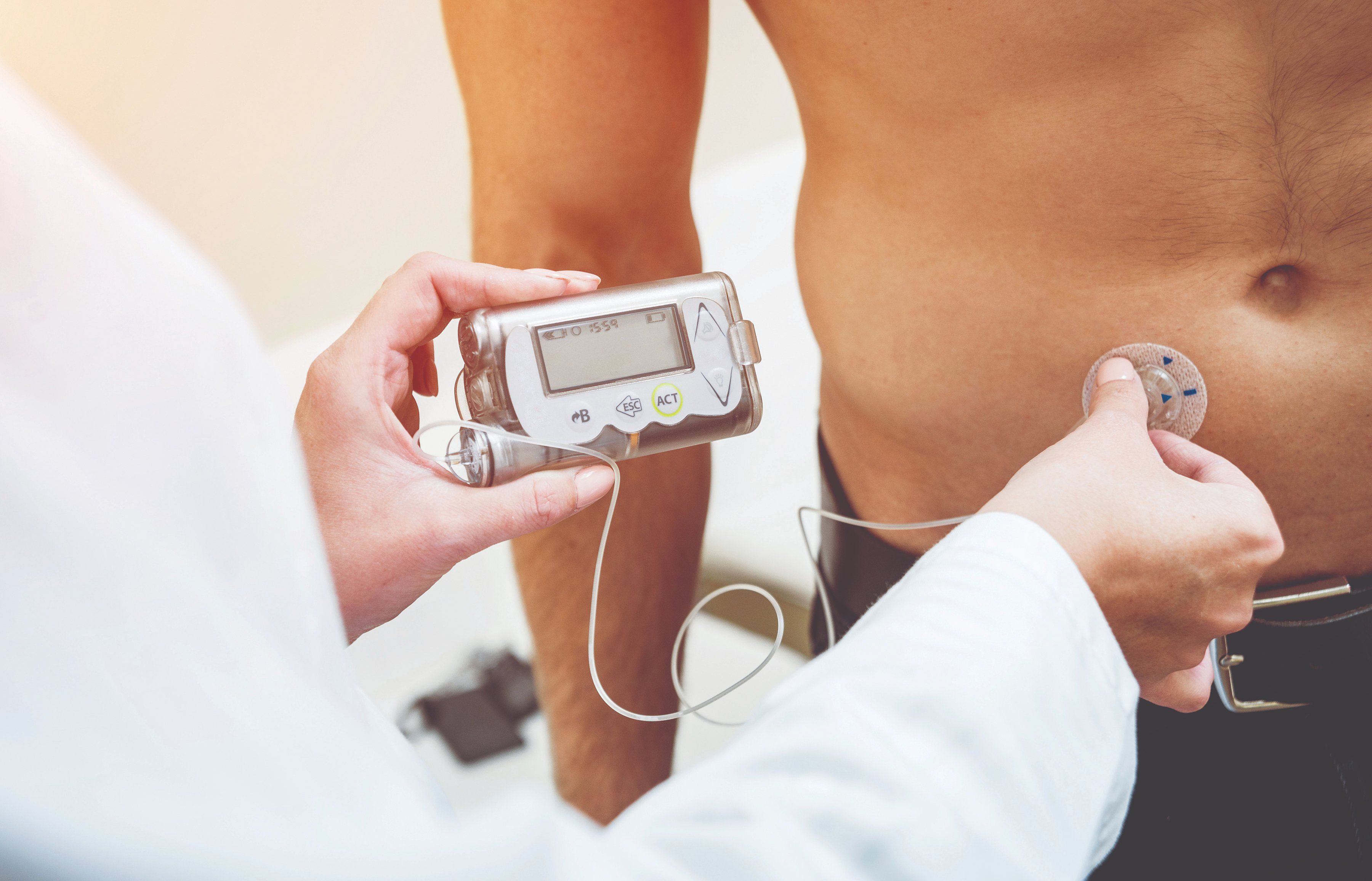 In Pediatric T1D, Race, Income, & Insurance Type Remain Significant ...