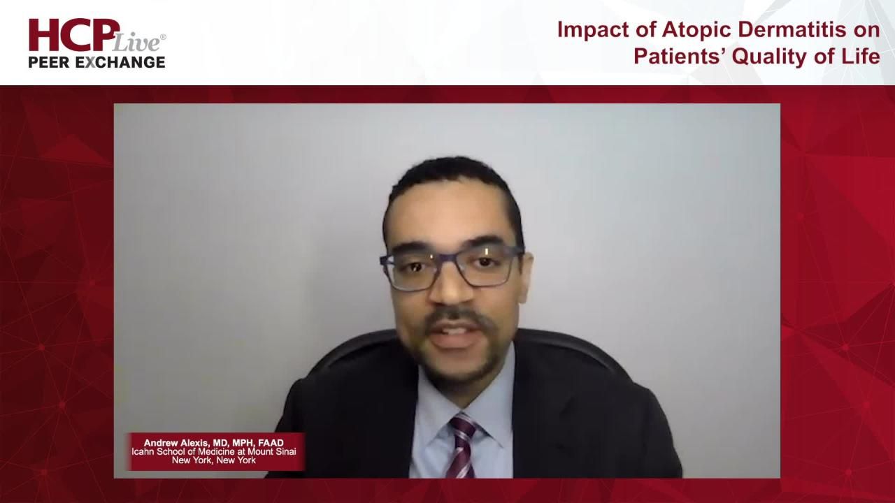 Impact of Atopic Dermatitis on Quality of Life