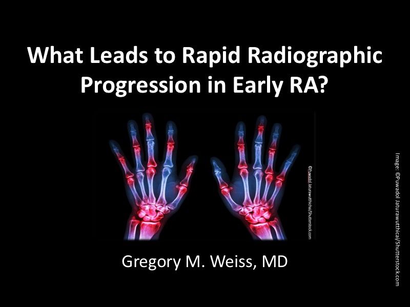 What Leads to Rapid Radiographic Progression in Early RA?