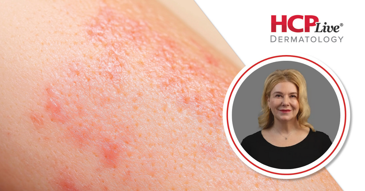 How to Better Use AI and Machine Learning in Dermatology, With Renata ...