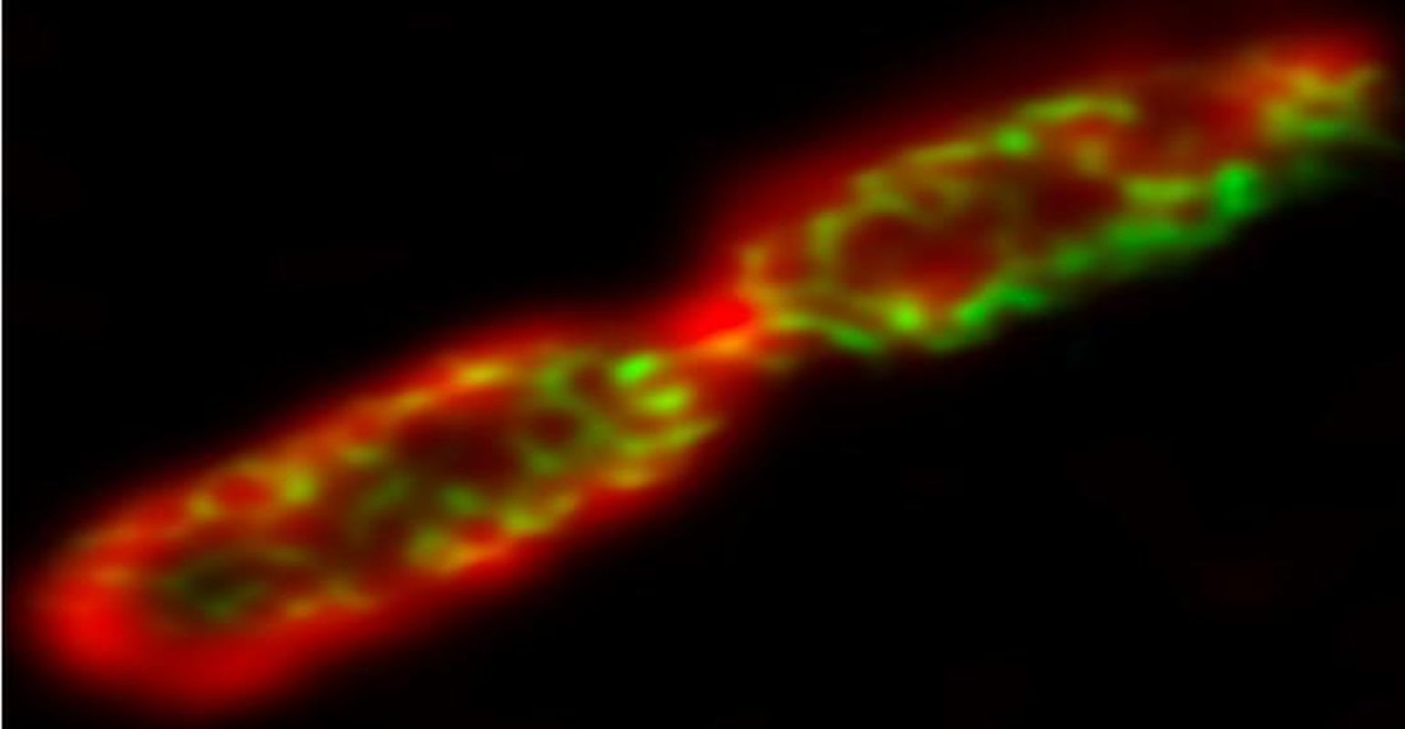 New Compound That Kills Antibiotic-Resistant Superbugs is Discovered ...