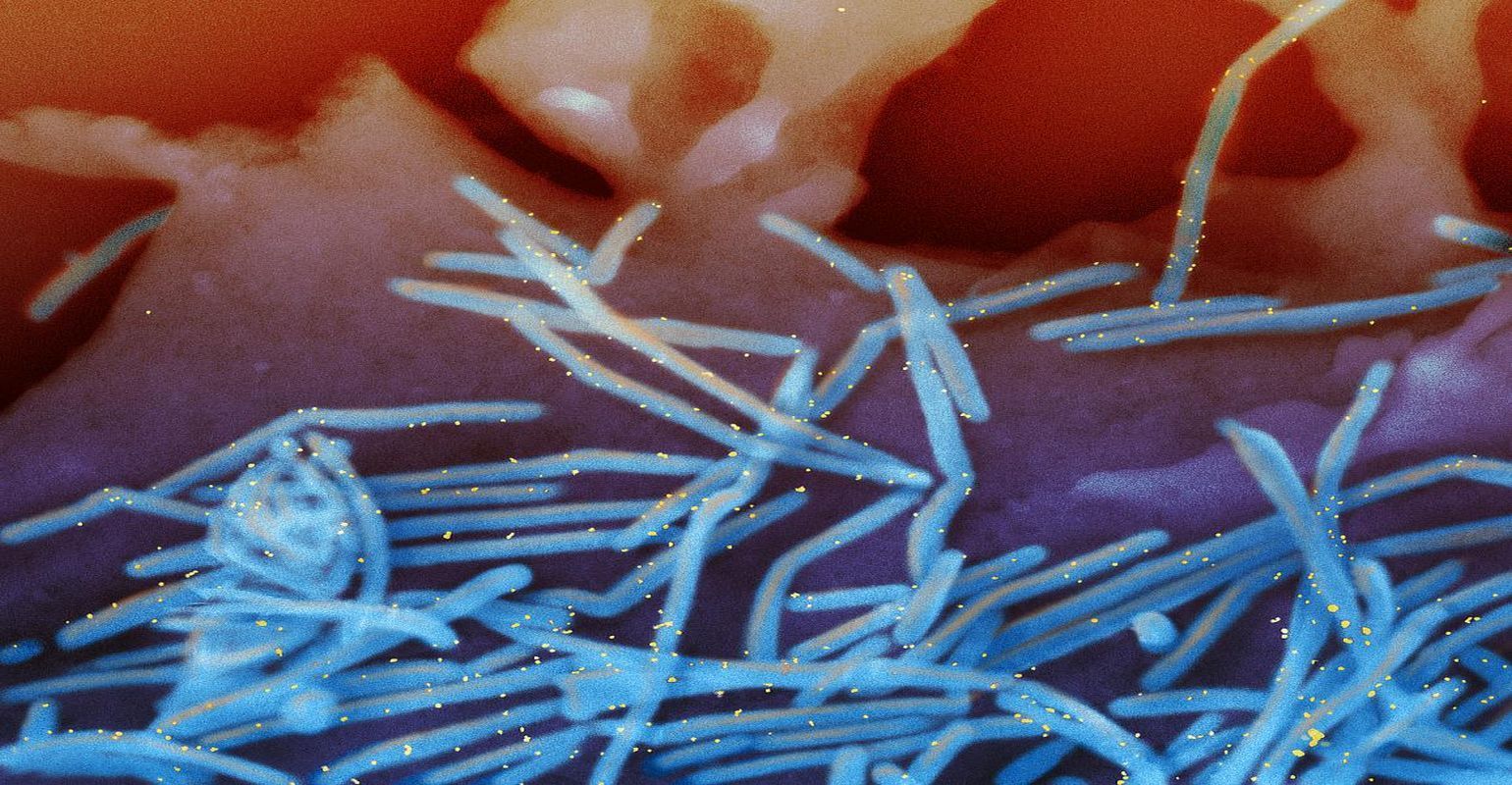 Early-stage Respiratory Syncytial Virus Vaccine Trial Begins ...