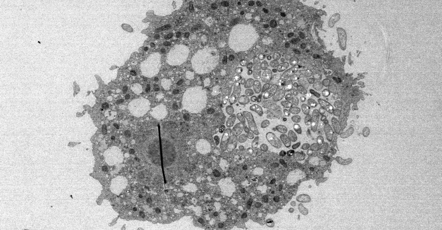 Vibrio Cholerae Microscope