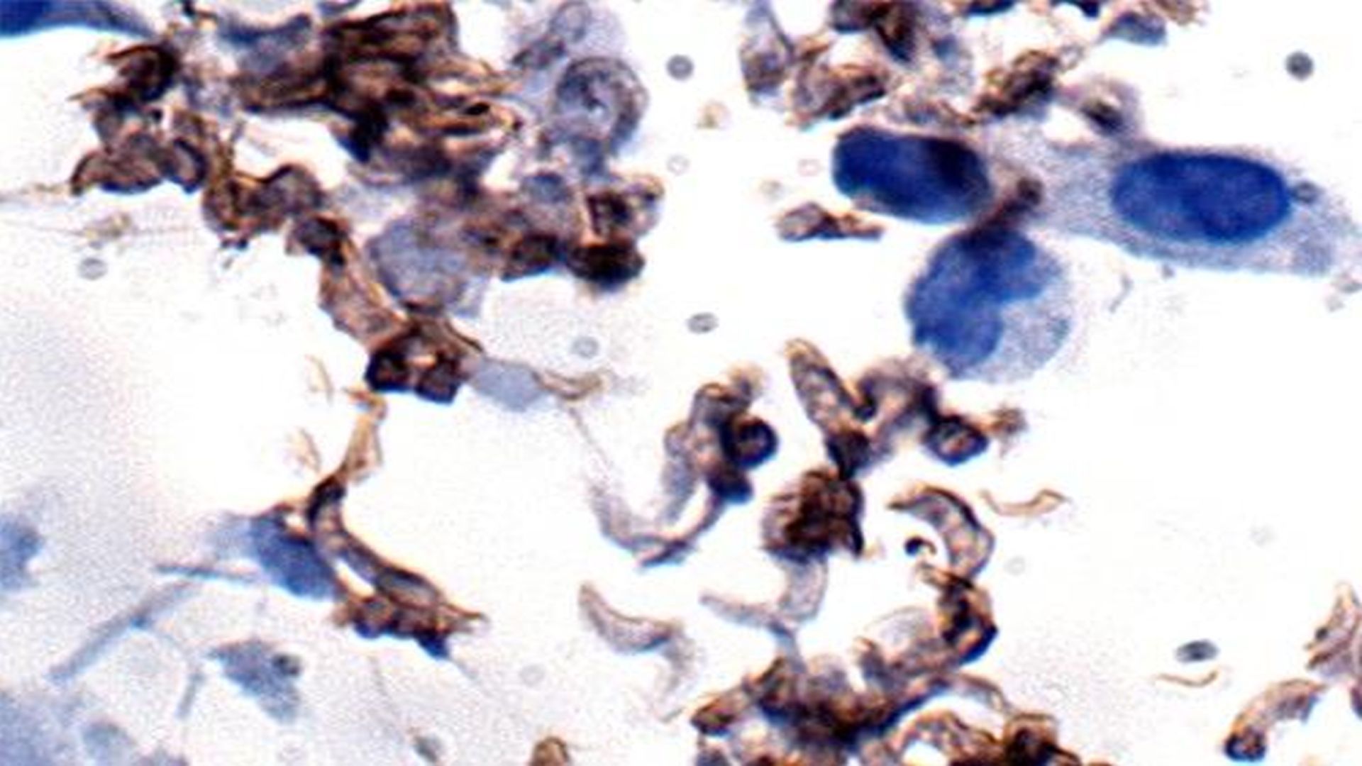 Understanding Which Clock Genes are Affected by Parasitic Disease Could ...