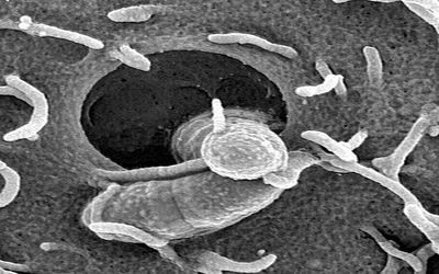 Scientists Study the Many Faces of the Bacterial Defense System ...