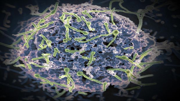 NIH Study of Ebola Patient Traces Disease Progression and Recovery ...