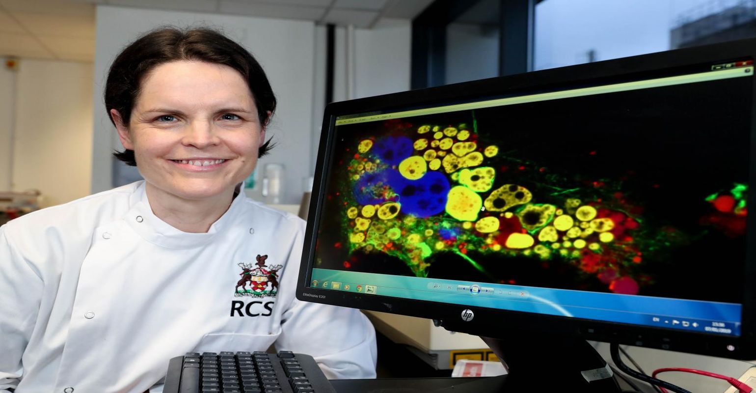 RCSI Researchers Develop New Tuberculosis Treatment RCSI Researchers Develop New Tuberculosis Treatment