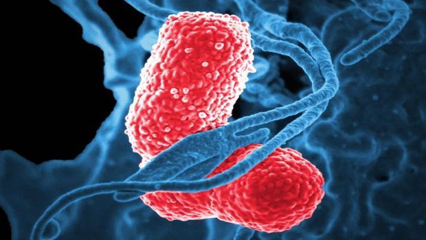Study Shows How Pneumonia-Causing Bacteria Invade the Body | Infection ...