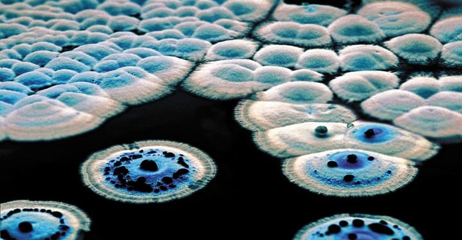 Time-Lapse Microscopy Helps Reveal Brake Mechanism in Streptomyces ...