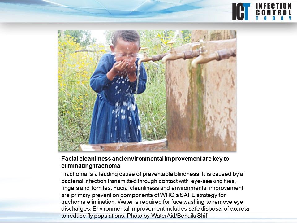 Slide Show: 10 Facts on Tackling Neglected Tropical Diseases