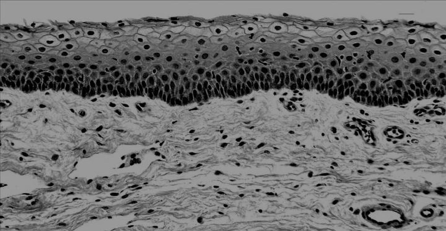 Different Bacteria Use Same Cell Surface Molecule To Invade Tissue And Promote Infection different-bacteria-use-same-cell-surface-molecule-to-invade-tissue-and-promote-infection