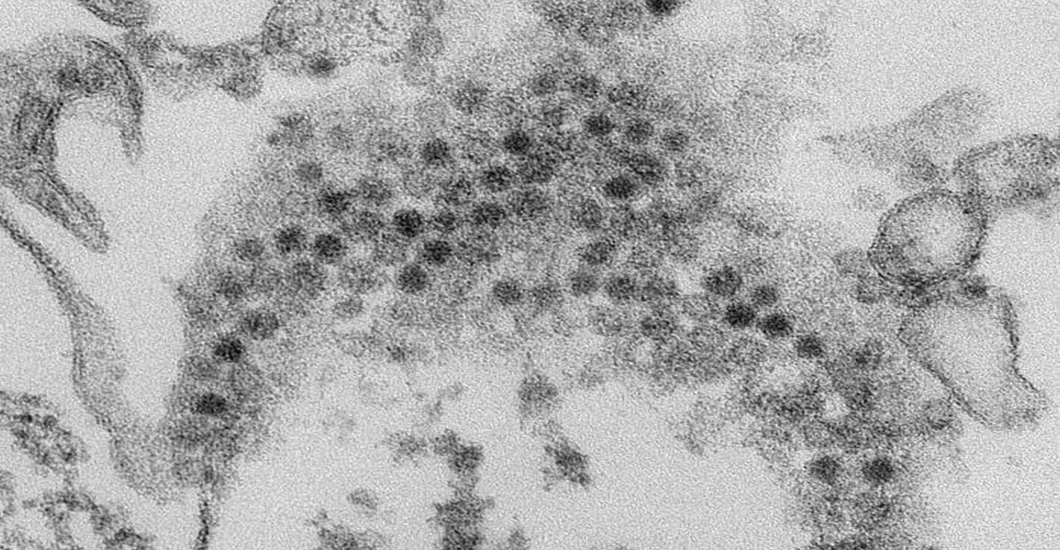 Acute Flaccid Myelitis Requires Galvanized Research Response ...