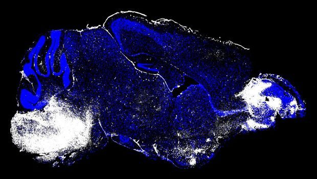 Immune System Cells Cause Severe Malaria Complication in Mouse Model ...