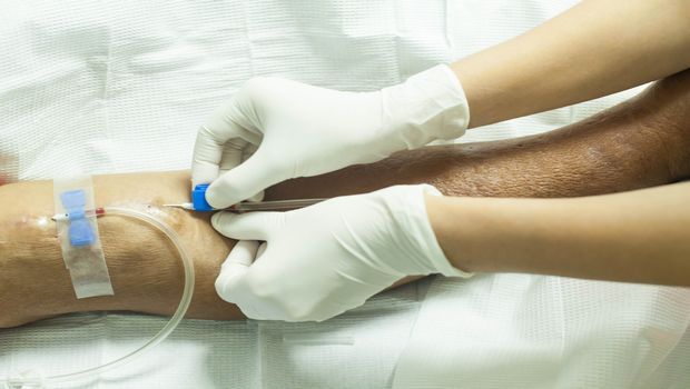 Exploring Approaches 'Beyond the Bundle' to Help Decrease Vascular ...