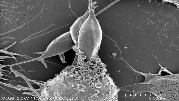 Discovery Explains How Leishmania Parasite Boosts Its Infection ...
