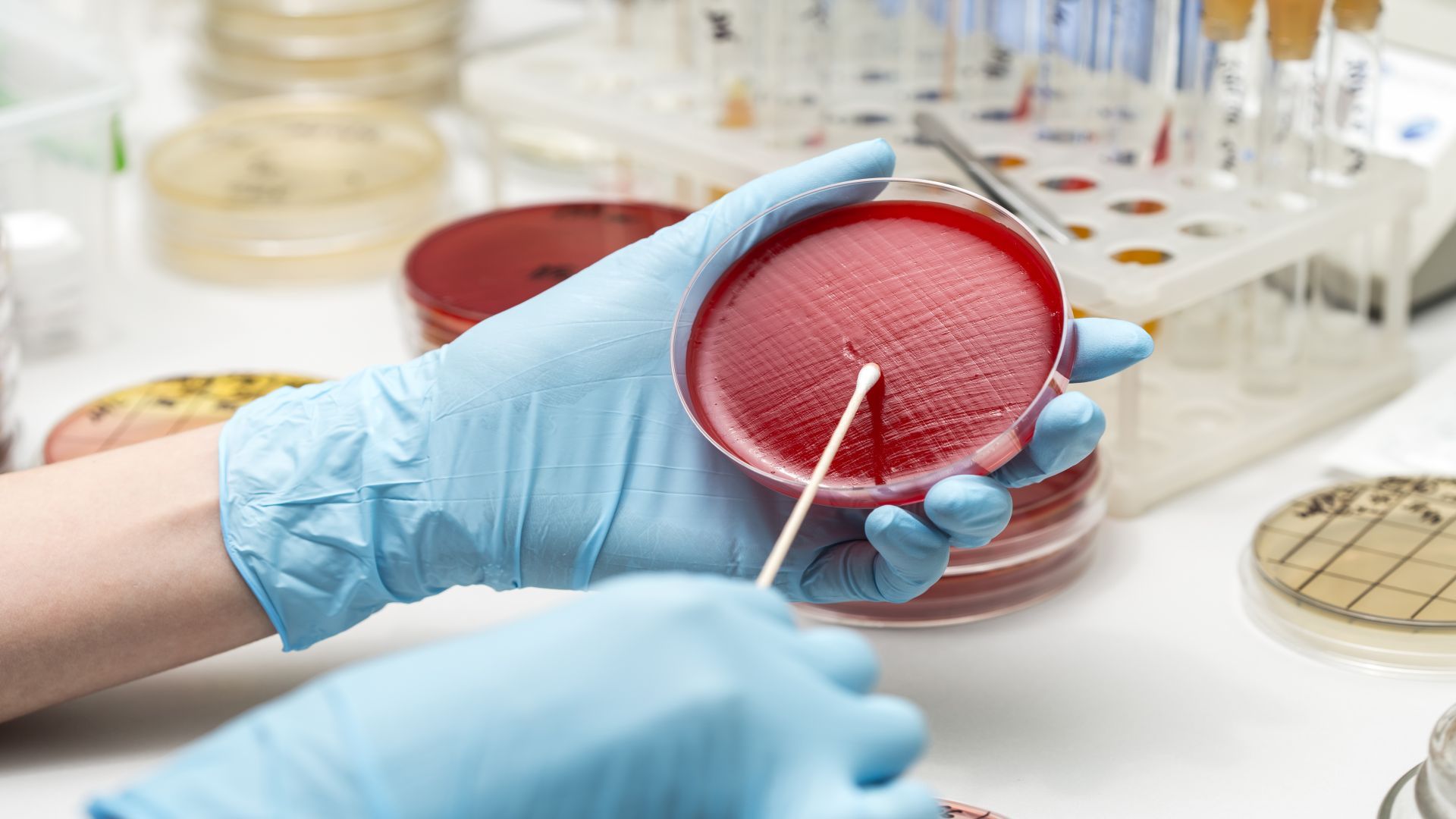CDC Invests More Than $200 Million to Help States Respond to Infectious ...