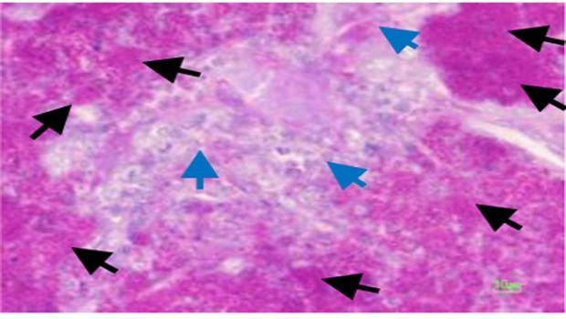 Fighting Penicilliosis | Infection Control Today