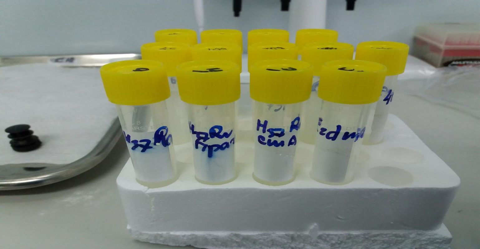 Physicists Develop New Method to Identify Antibiotic-Resistant Bacteria Physicists Develop New Method to Identify Antibiotic-Resistant Bacteria