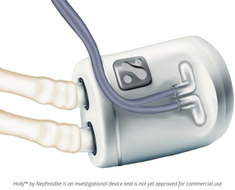 FDA grants Breakthrough Device status to Nephrodite's implantable ...