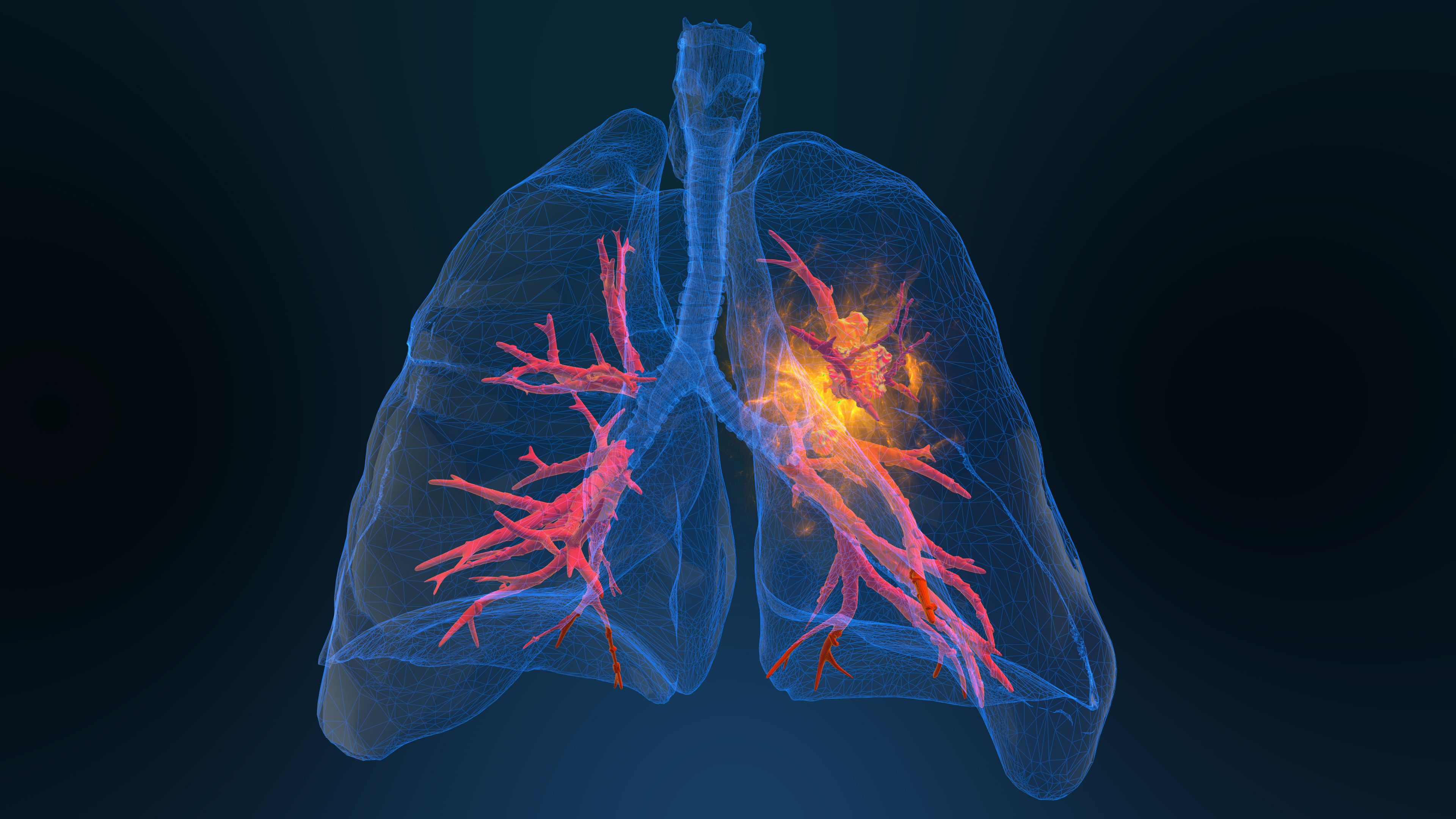 FDA Approves Augtyro to Treat ROS1 Positive Lung Cancer