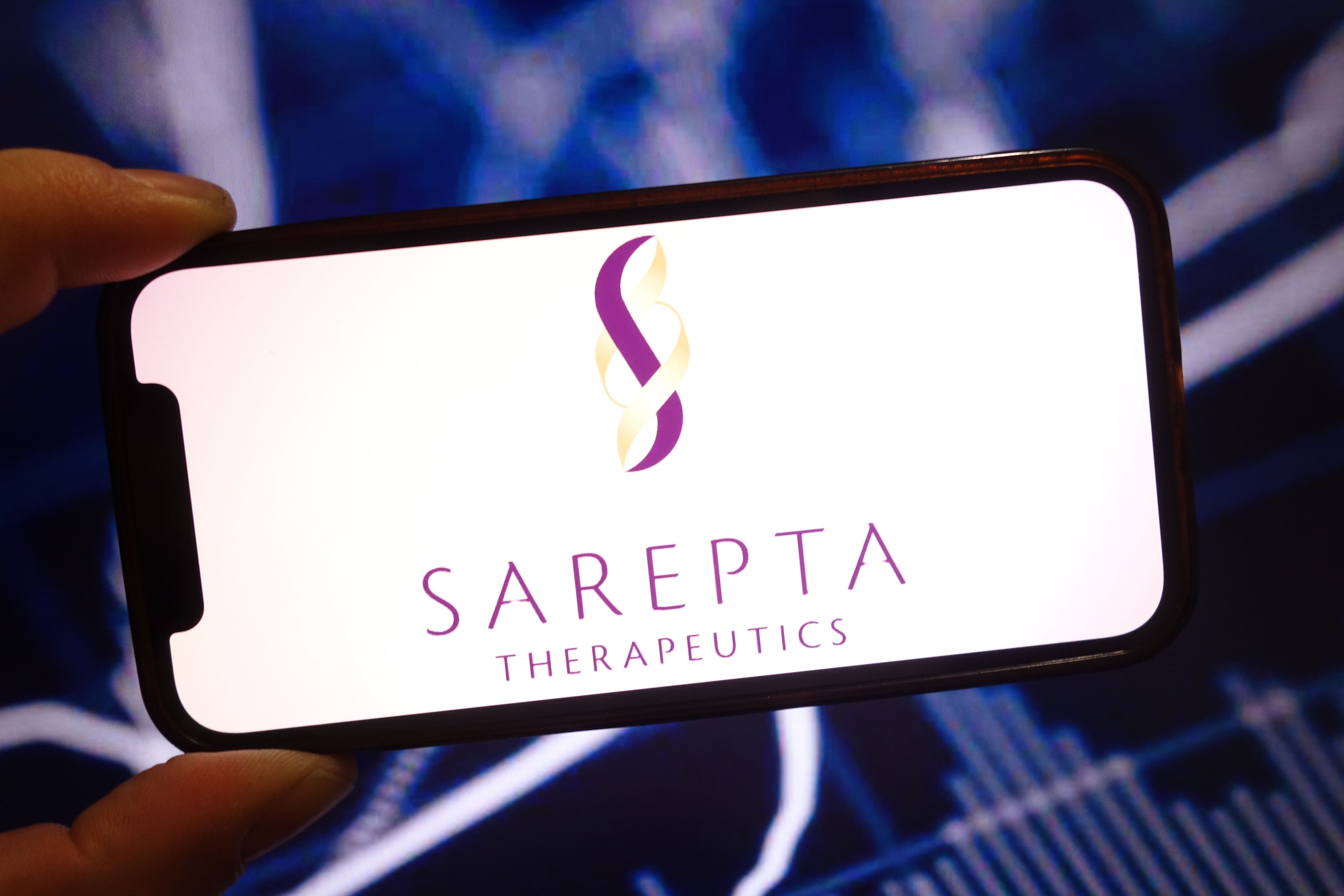 Sarepta to Resume Shipping Elevidys For Ambulatory Duchenne Patients