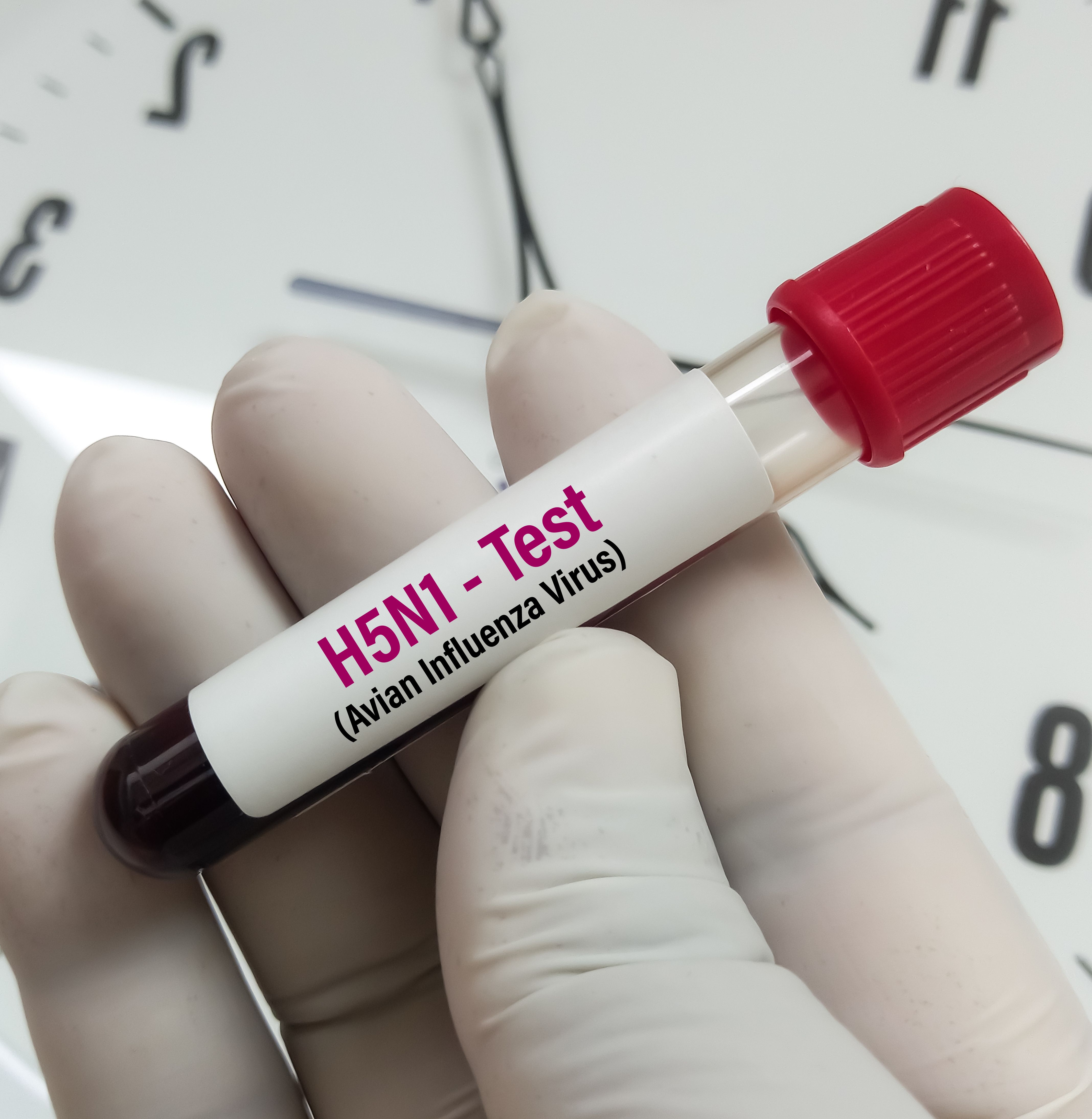 CDC: Human Risk from H5N1 Bird Flu is Low | ID Week 2024 | Managed ...