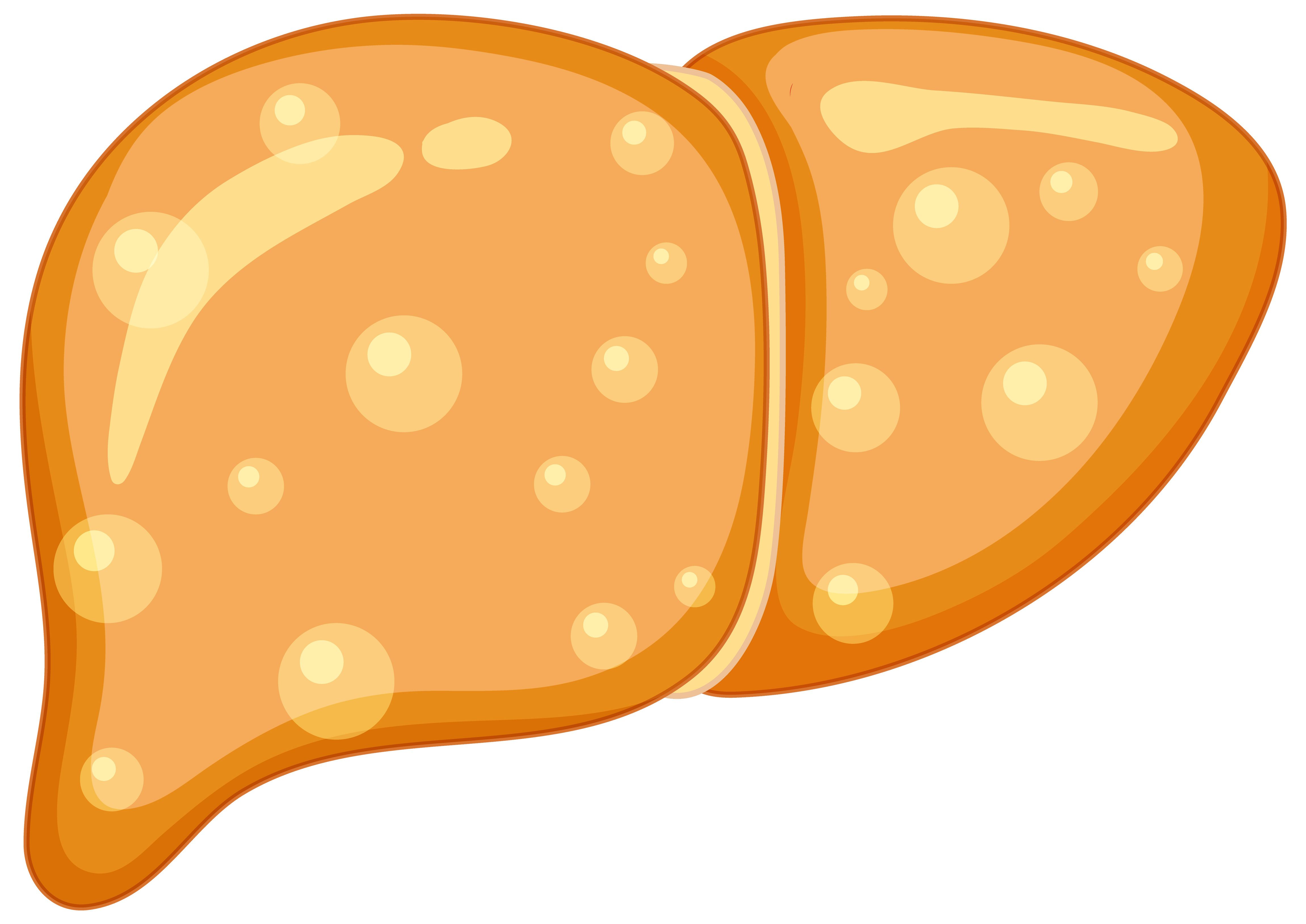 SGLT2 Inhibitors Superior to Other Oral Diabetes Drugs for People with ...
