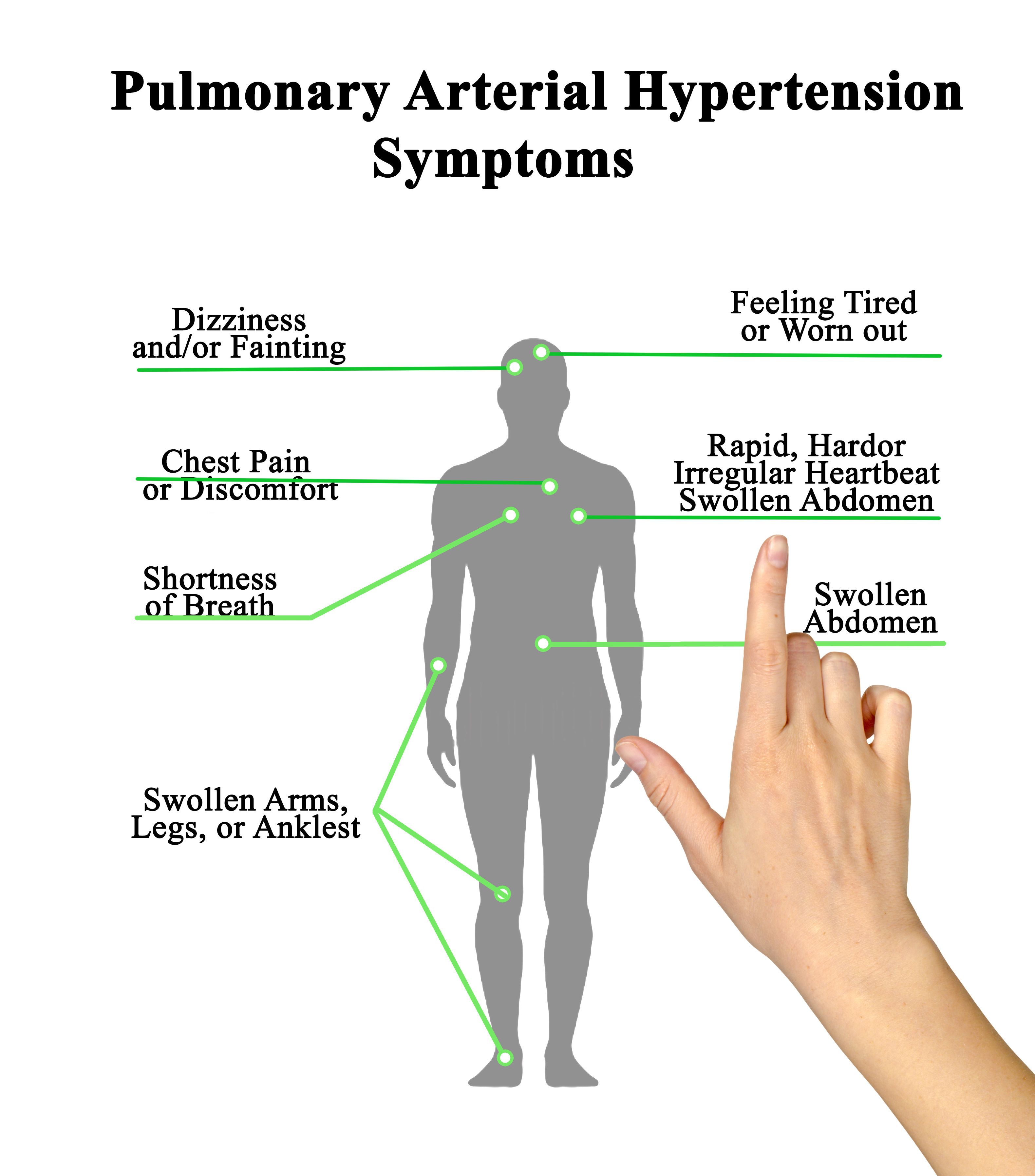 FDA Approves Combination Therapy for Pulmonary Arterial Hypertension