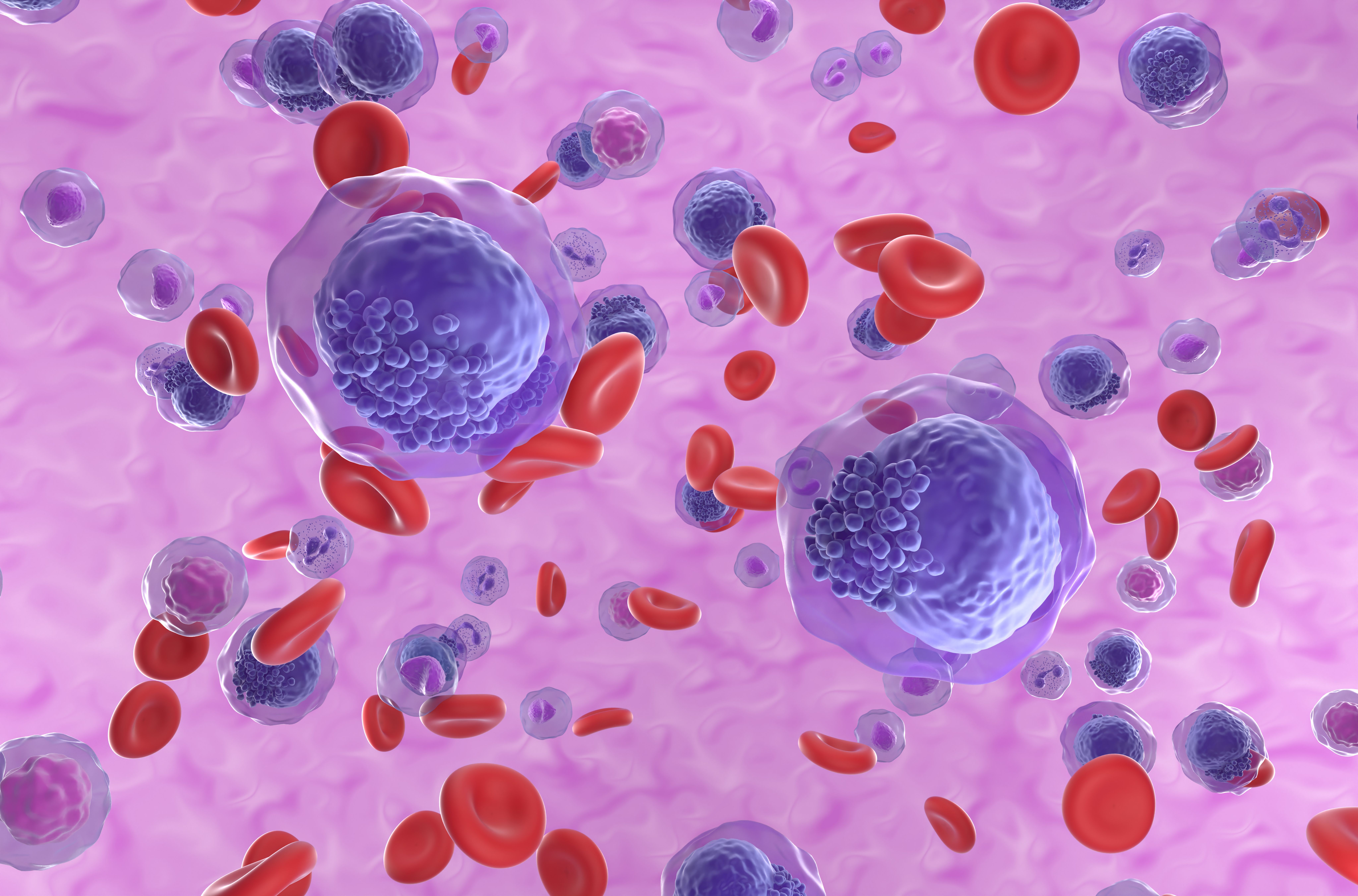 Grafapex Approved for Reduced-Intensity Stem Cell Transplants in AML ...