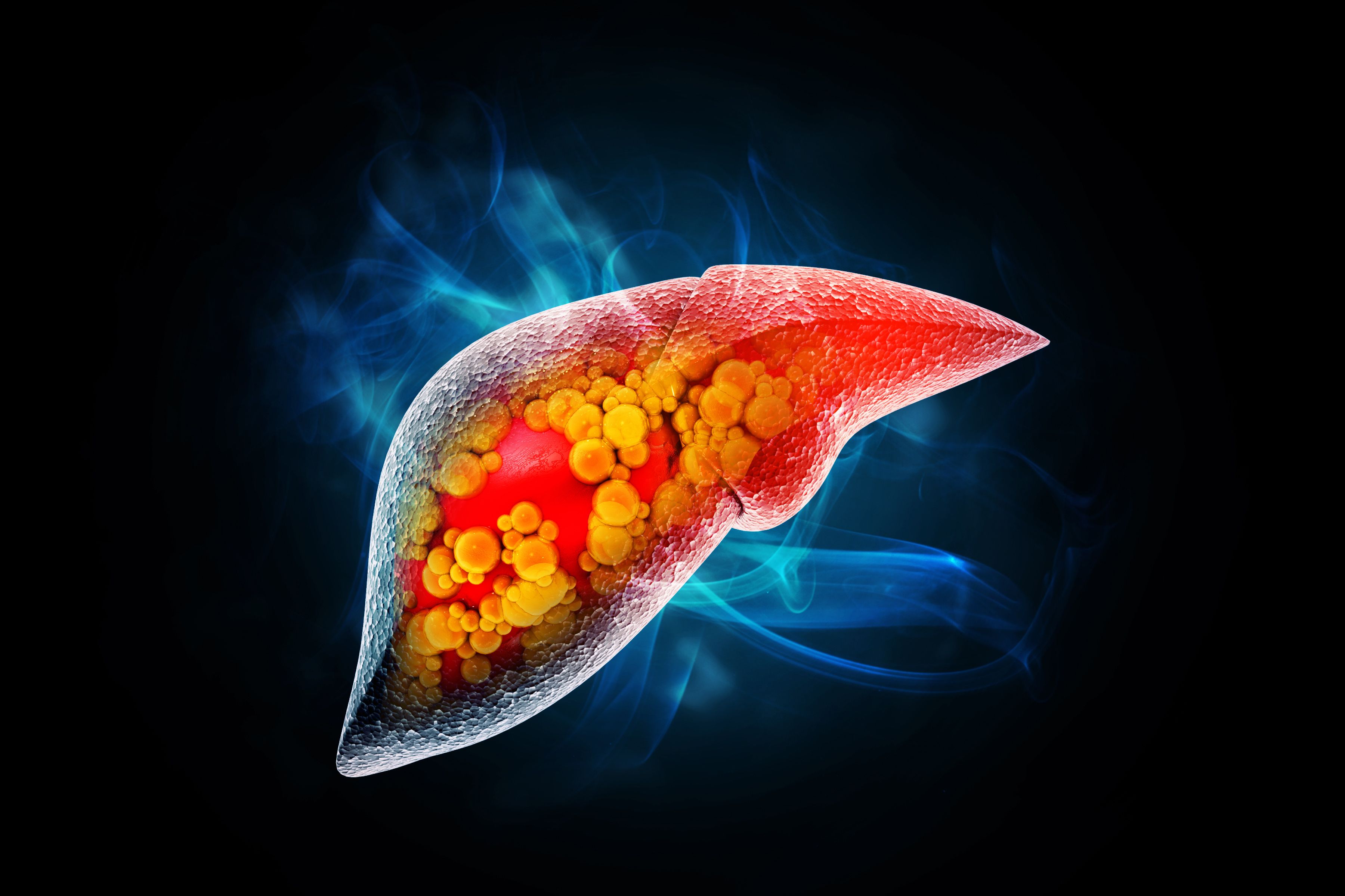 Semaglutide Improves Liver Fibrosis In New Trial Analysis Holistic Vive