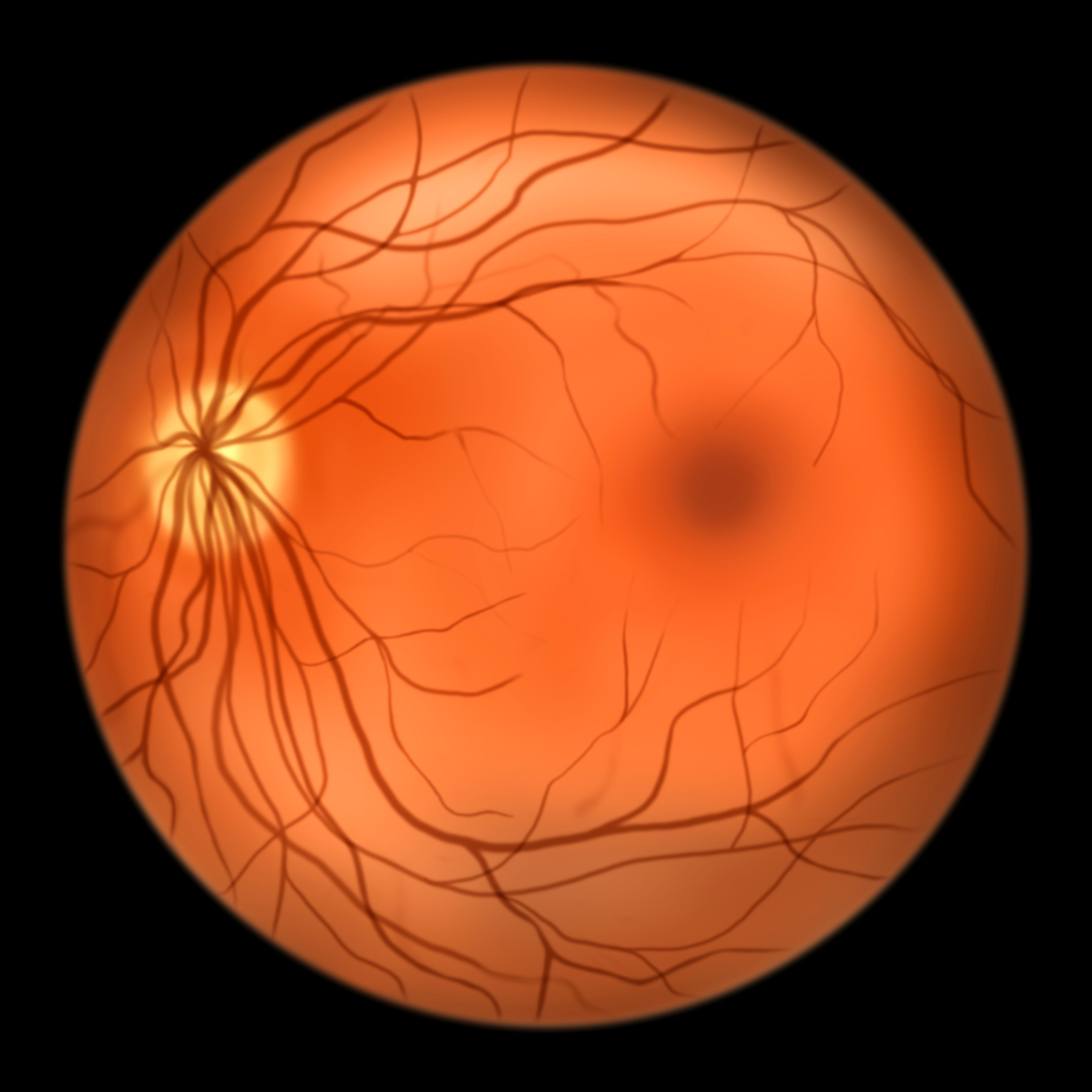 FDA Sets Action Date for Eylea HD in Retinal Vein Occlusion | Managed ...