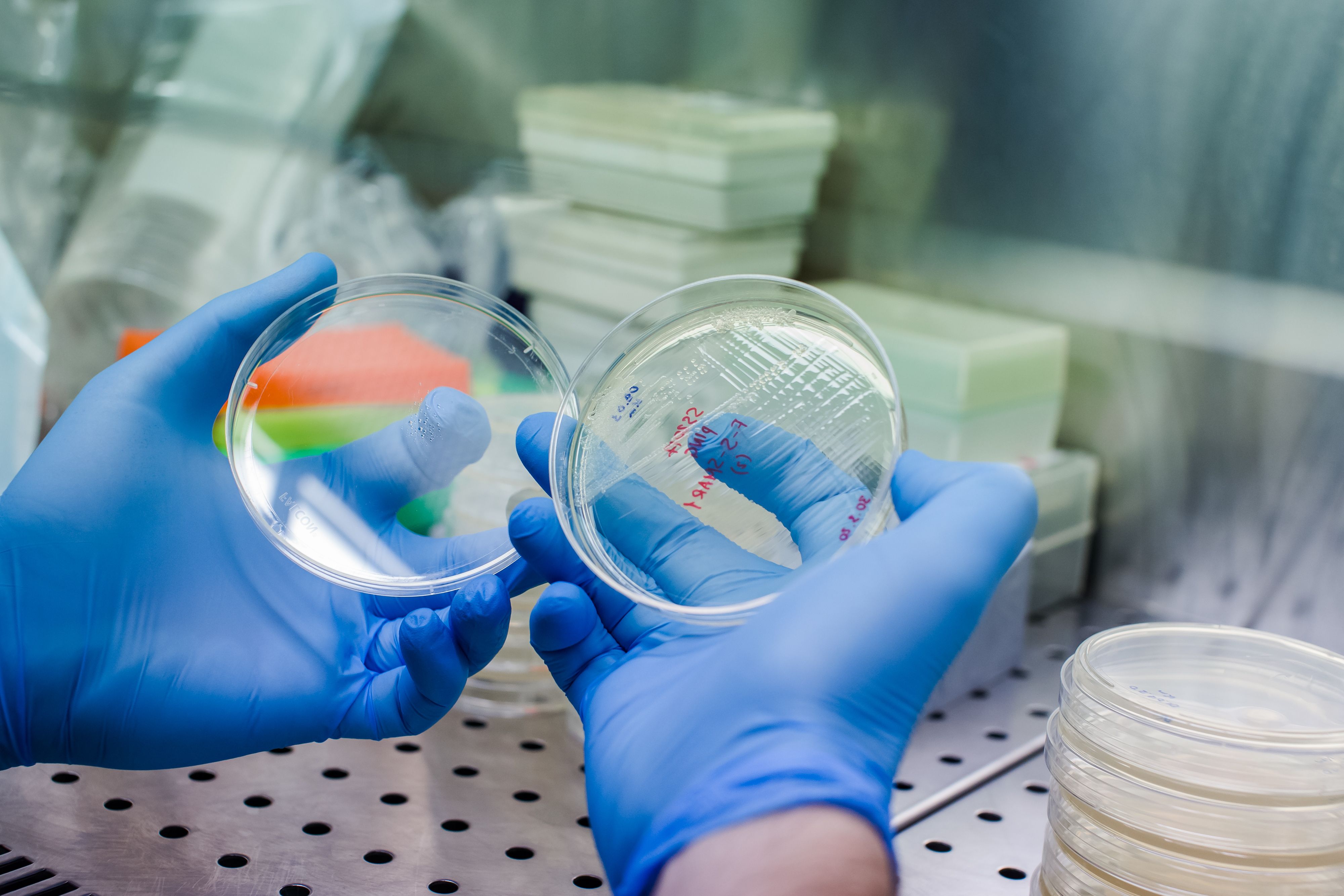 FDA clears BMS CAR-T cell therapy, Merck MET inhibitor