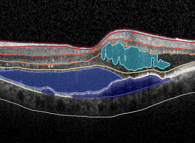 Retinai Launches Discovery Core Ai Powered Collaborative Platform To Accelerate Clinical And