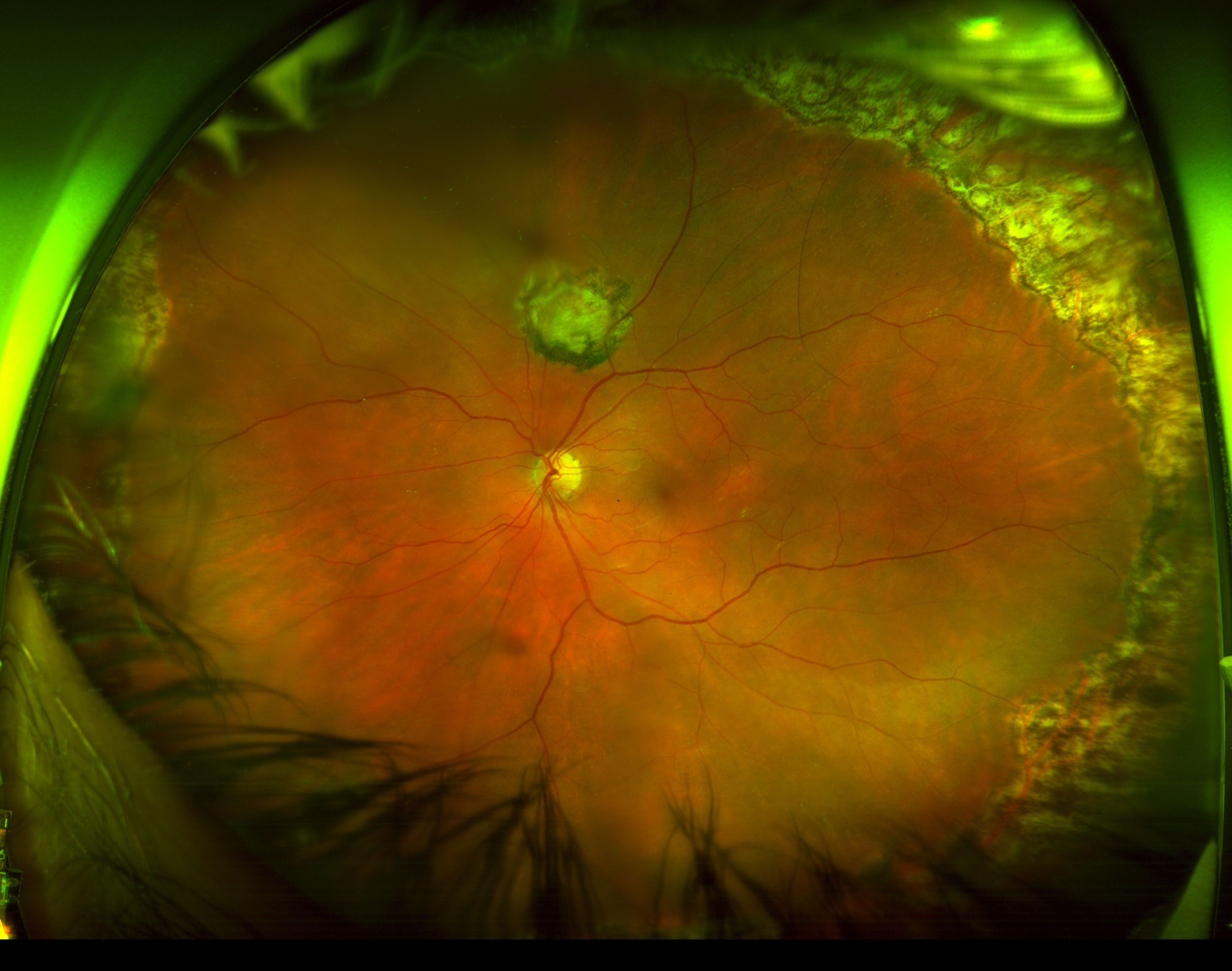 Ultra-widefield imaging can enhance efficiency for practices | Modern ...