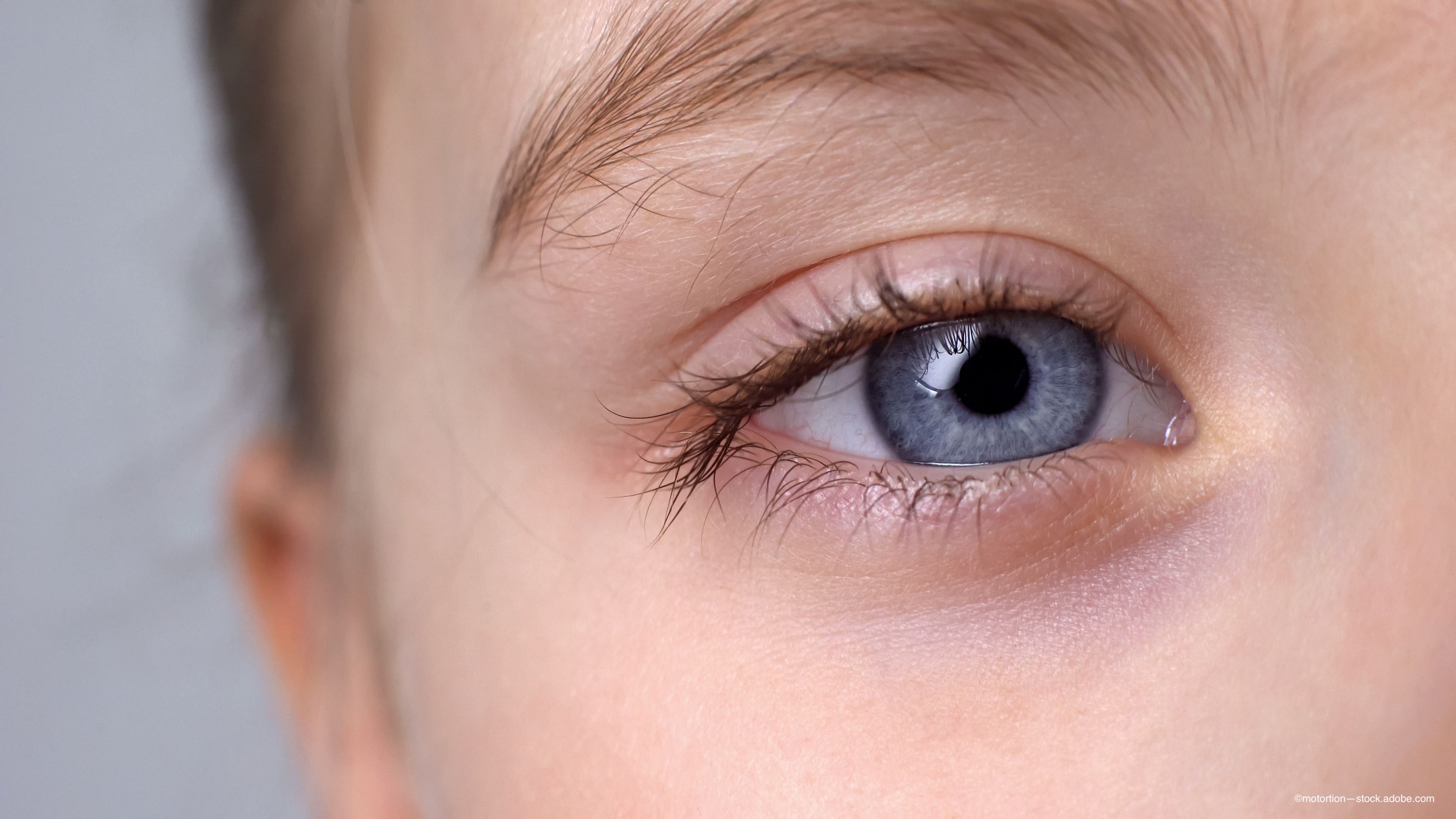 Pediatric ophthalmologists target inherited retinal diseases | Modern ...