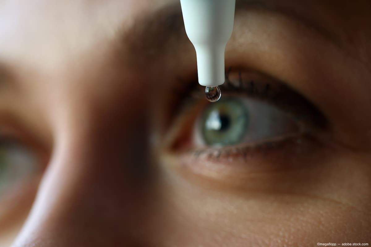 Phase Ib/IIa trial of EXN407 eye drops from Exonate demonstrates safety ...