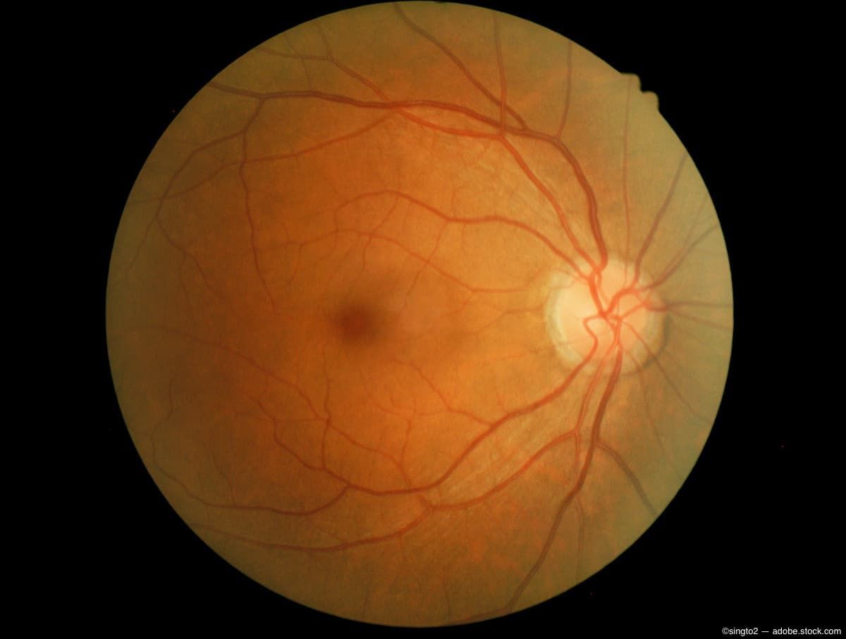 Retinal vascular health: 4 insights ophthalmologists should keep top of ...