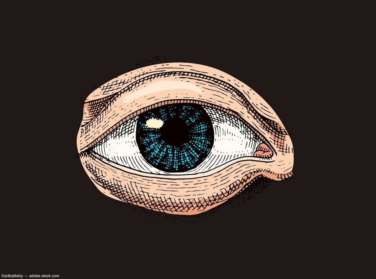 Study suggests JAK inhibitors may reduce AMD risk in autoimmune disease ...