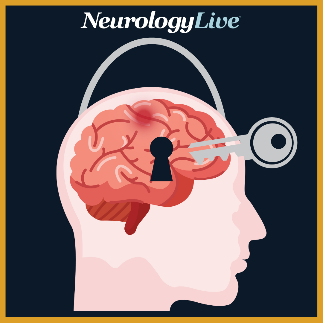 Cerebroprotection As An Approach for Ischemic Stroke Care