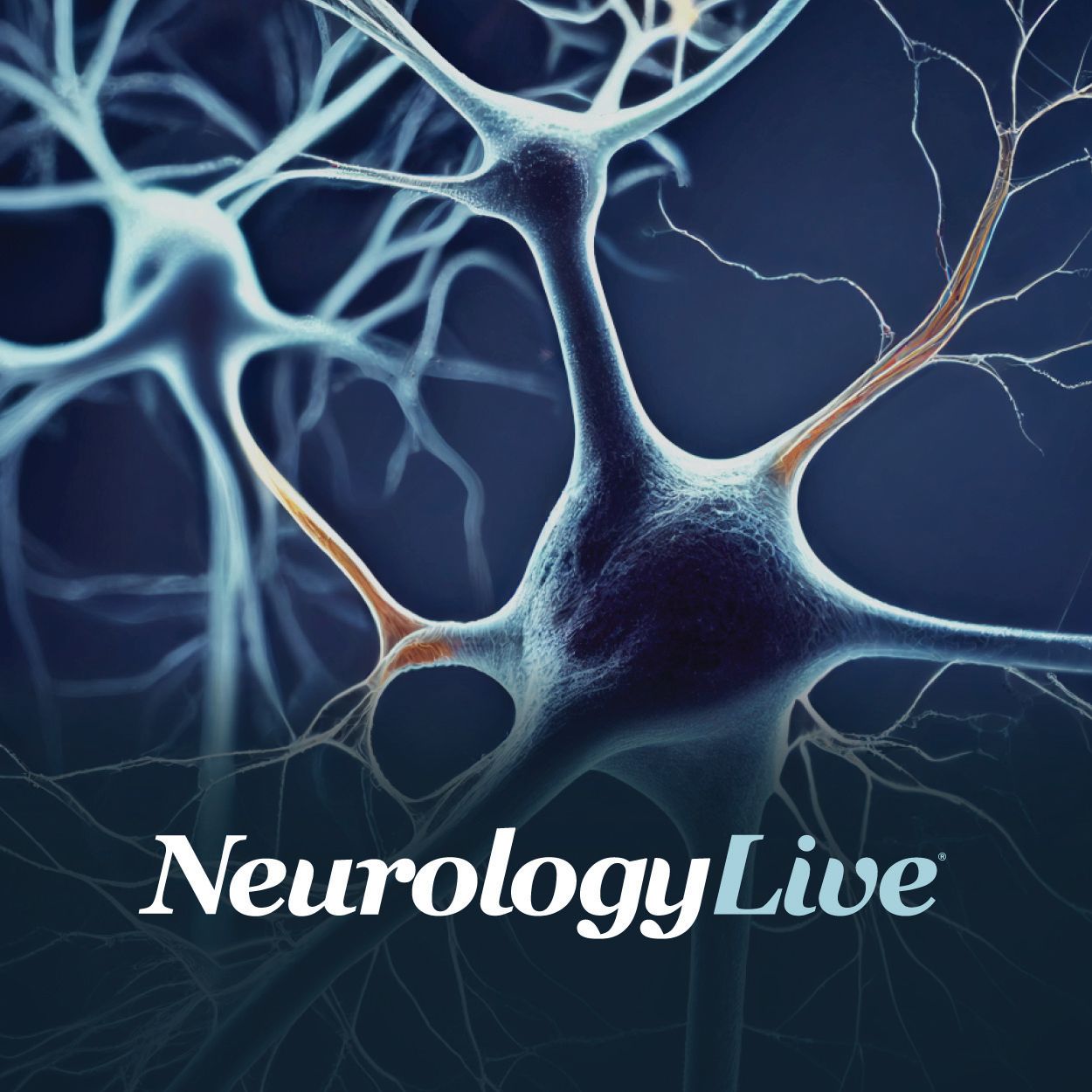 Rare Neuromyelitis Optica Spectrum Disorder Case Complicated By Posterior Reversible